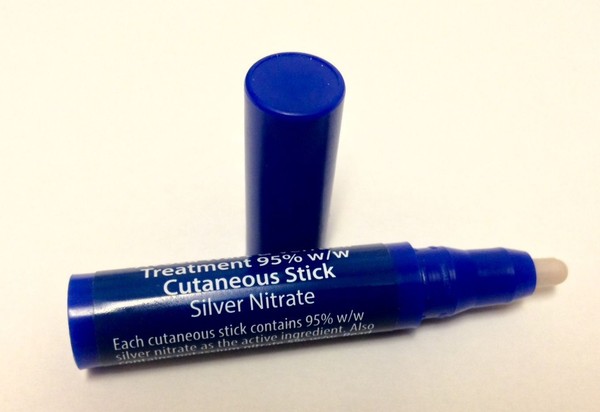 Caustic Pencil Human Treatment Silver Nitrate Stick Kit Avoca Wart ...