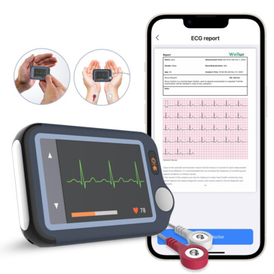 ECG EKG Monitor 30s/60s/5min Recording AI-ECG Analysis Report in App PC ...