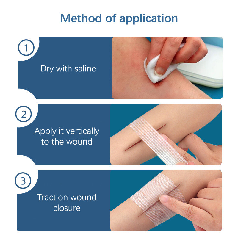 2/3/5Pcs Adhesive Bandages Waterproof Band Aid Emergency Kit Bandages ...