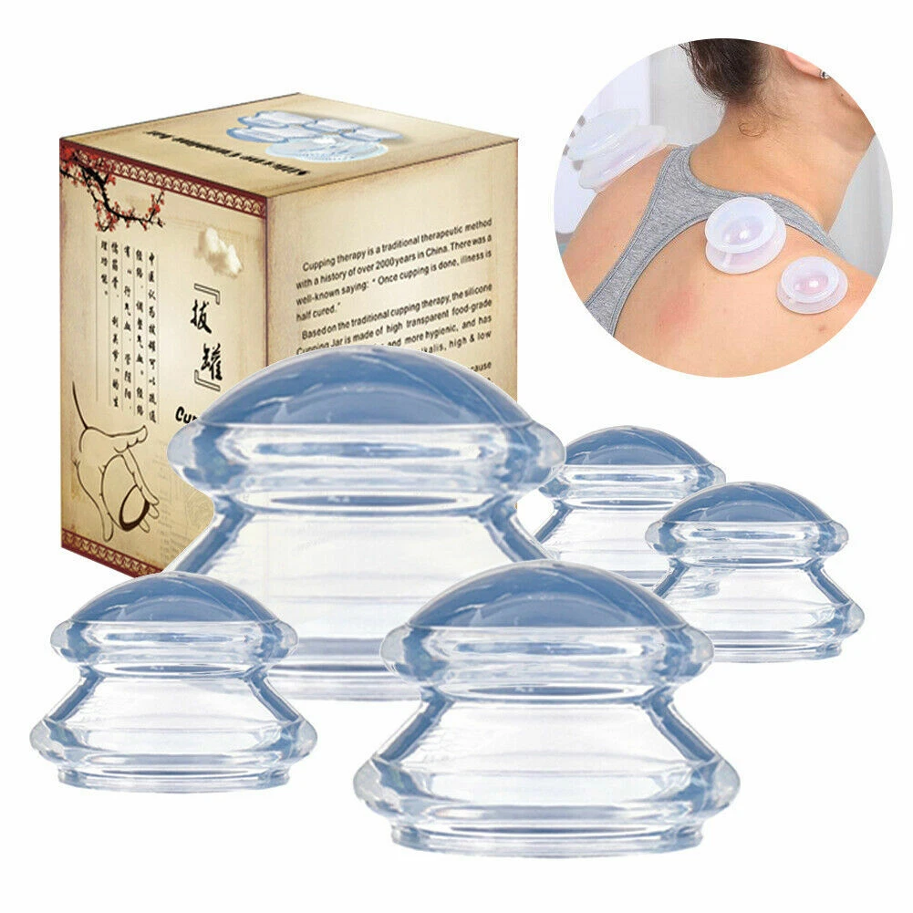 Cupping Therapy Chinese History
