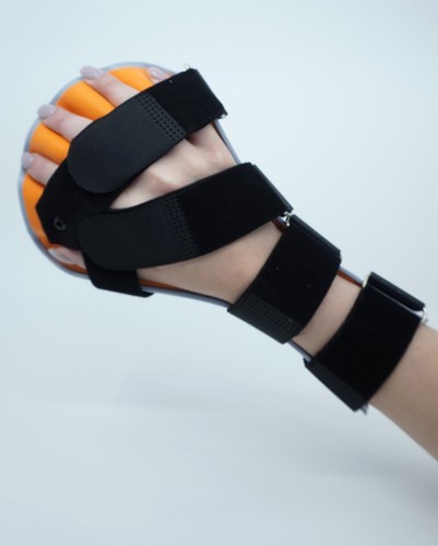 Anti Spasticity Hand Fingers Splint Orthosis - Stroke Cerebral Palsy ...