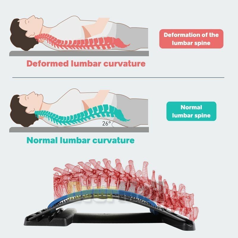 Multi-Level Back Stretcher Lumbar Support Device Pain Spine Relief ...