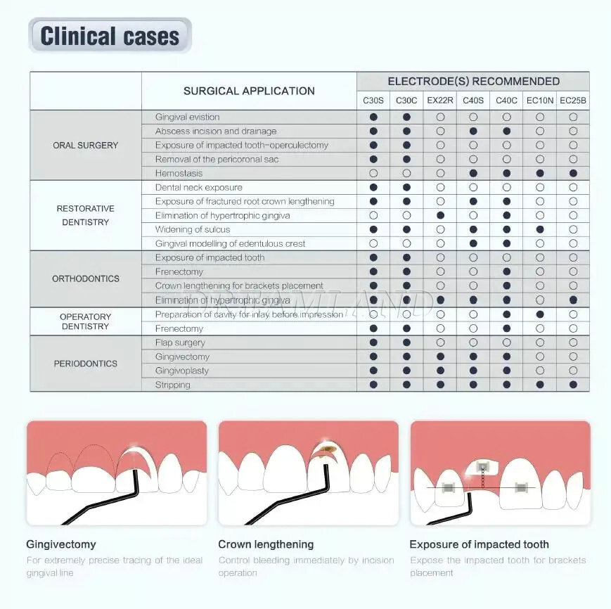 Operculectomy Code E‐Poster 2023 Clinical Oral Implants Research