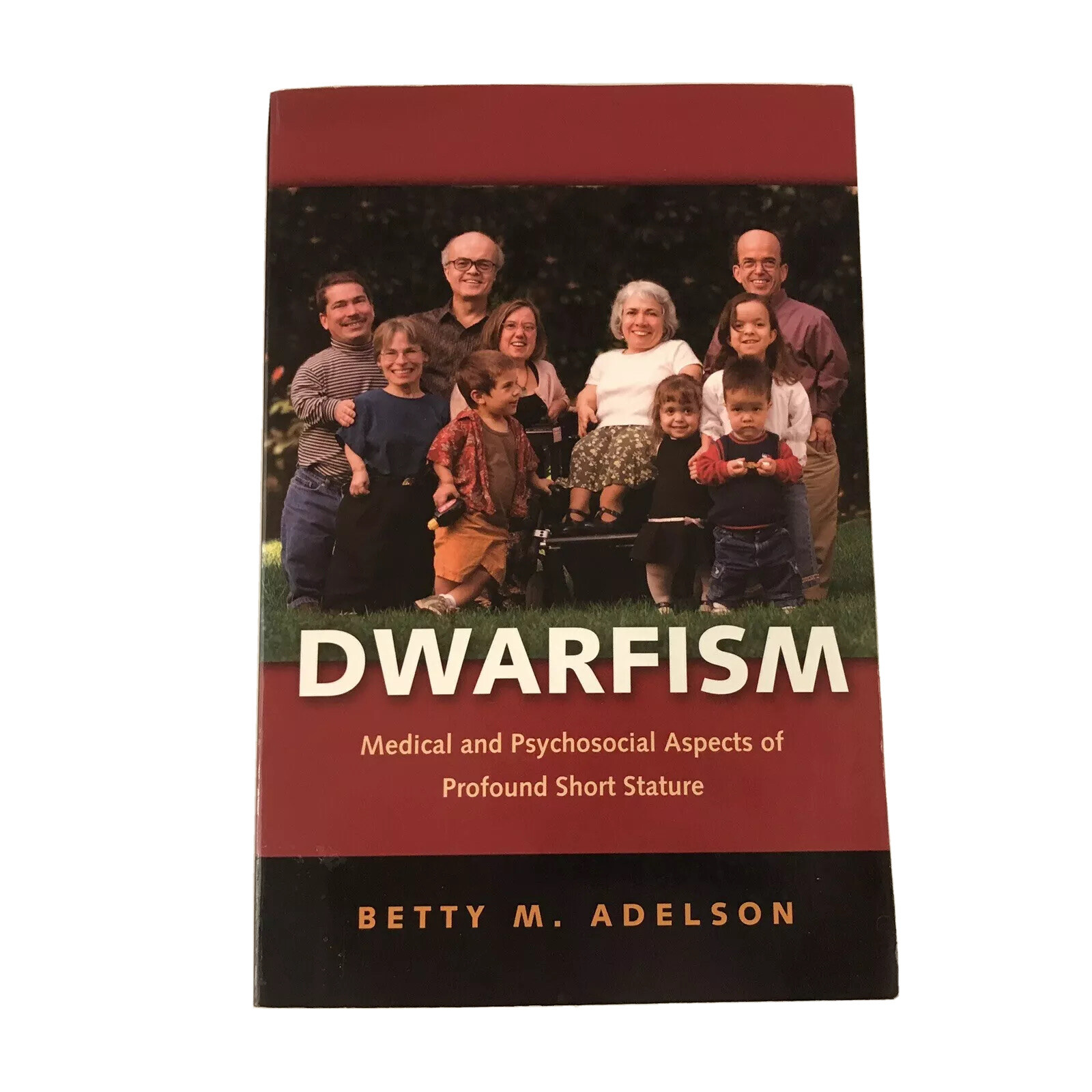 Dwarfism: Medical and Psychosocial Aspects of Profound Short Stature ...