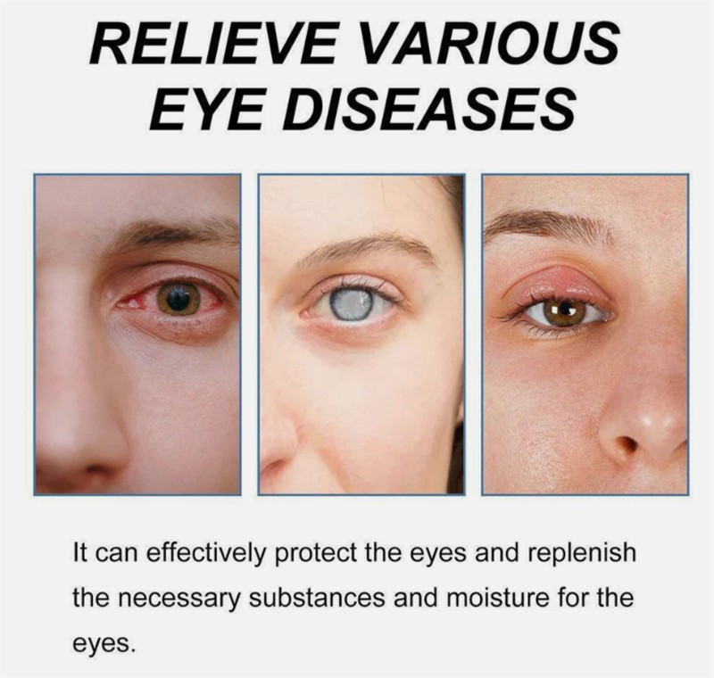 Cataract Removal Eye Drop Improve Blurred Vision Restore Eyesight Hot ...