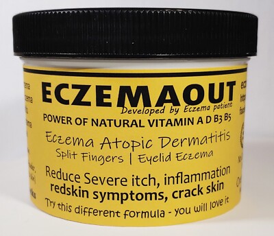 Perioral Dermatitis Cream | Redness & Itch Relief | Non-Steroidal ...