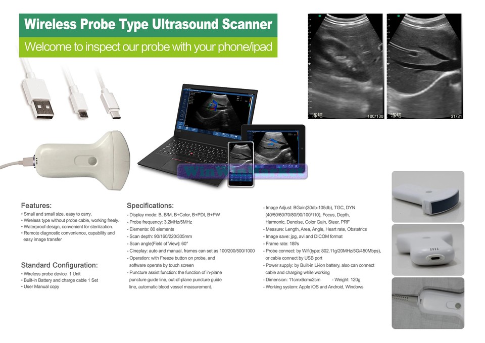 128E Wireless Ultrasound Probe Scanner WIFI Support iOS Android Windows ...