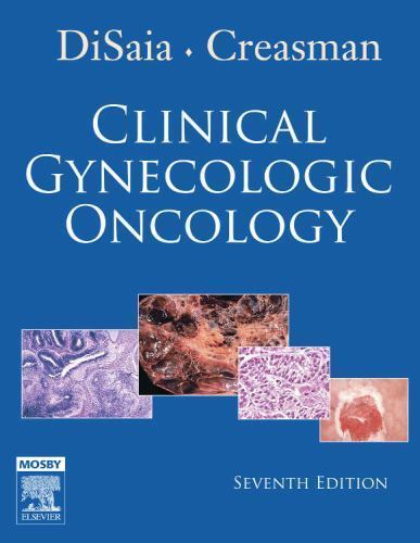 Clinical Gynecologic Oncology (Clinical Gynecologic Cncology), Creasman ...