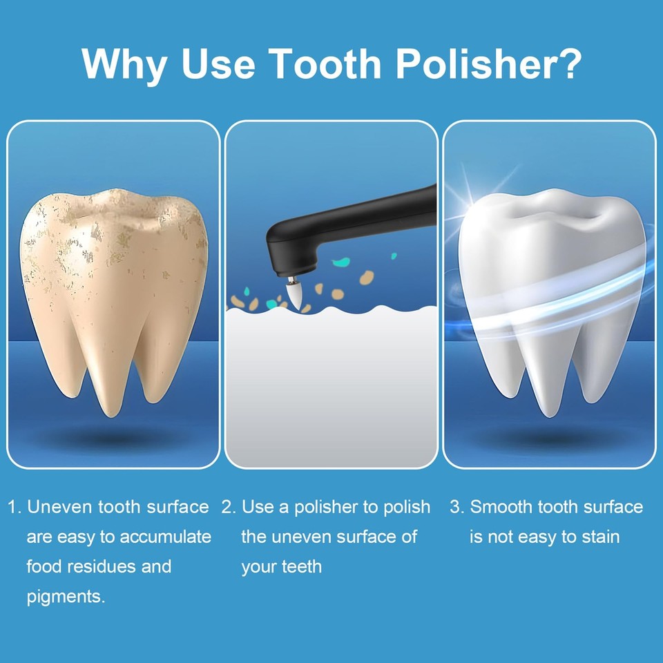 Tooth Polisher - SIQUER Plaque Remover for Teeth 1 Count (Pack of 1 ...