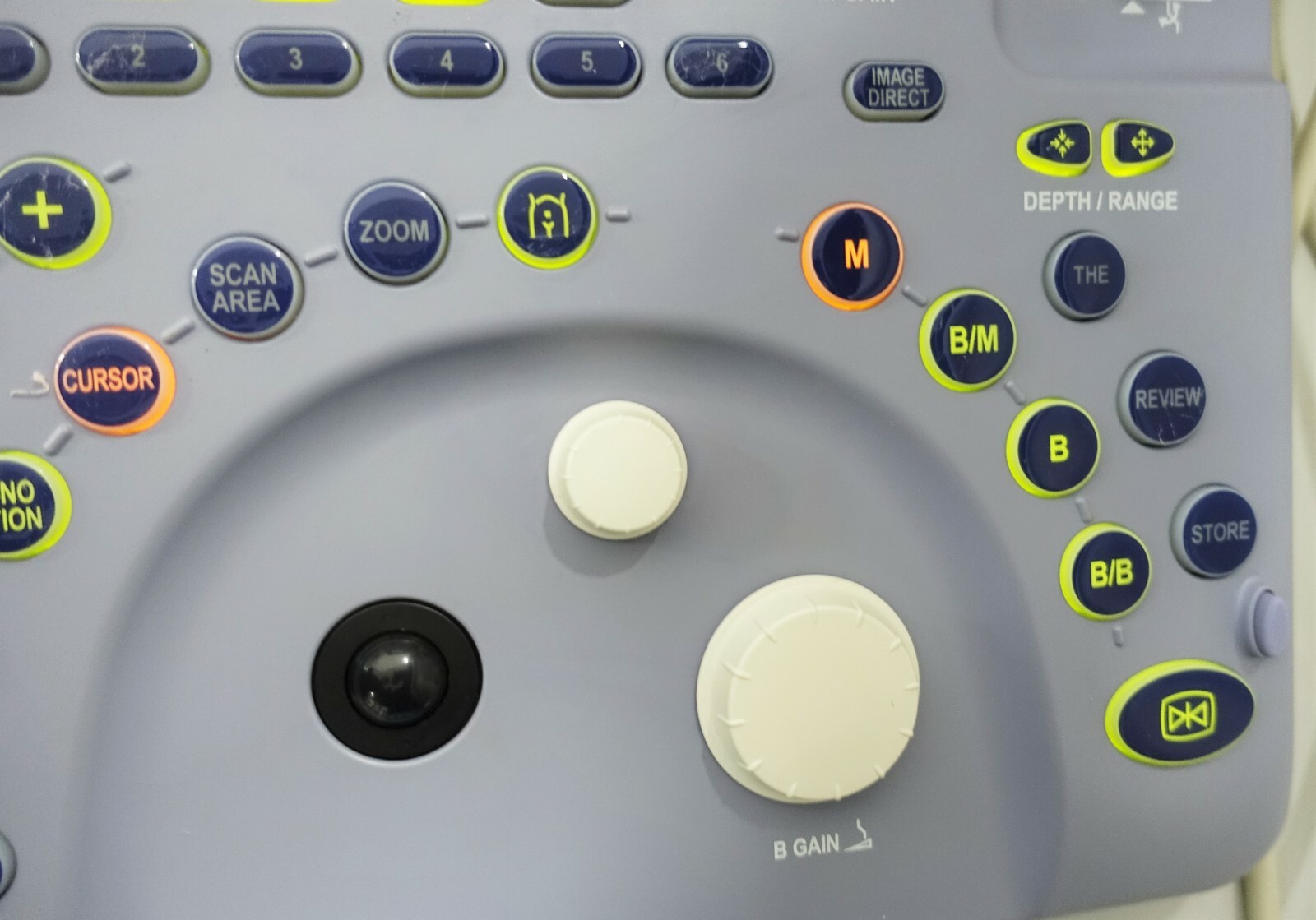 HITACHI ALOKA PROSOUND 2 DIAGNOSTIC ULTRASOUND P2 PORTABLE w UST-934N-3 ...