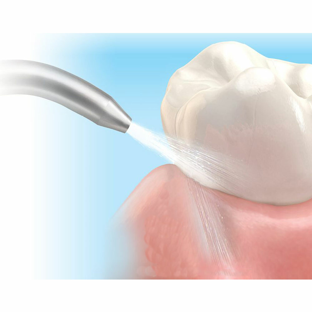 Dental DSI Prophy Air Prophylaxis Powder Teeth Polish Stain Remove ...