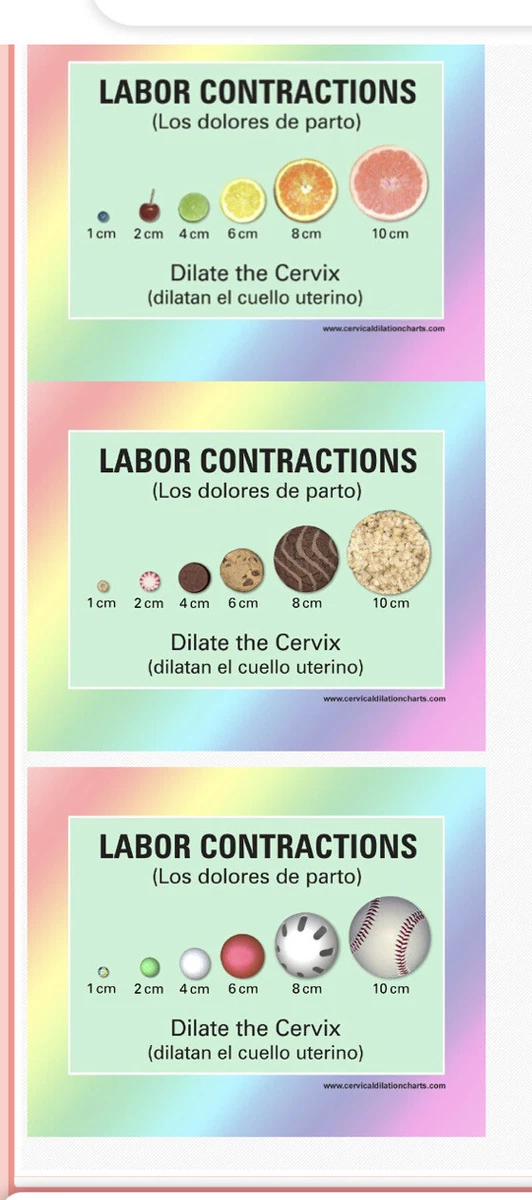 Cervix Dilation Chart Labor