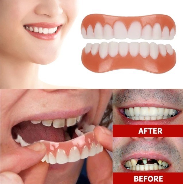 Denture Upper Lower Instant Veneers