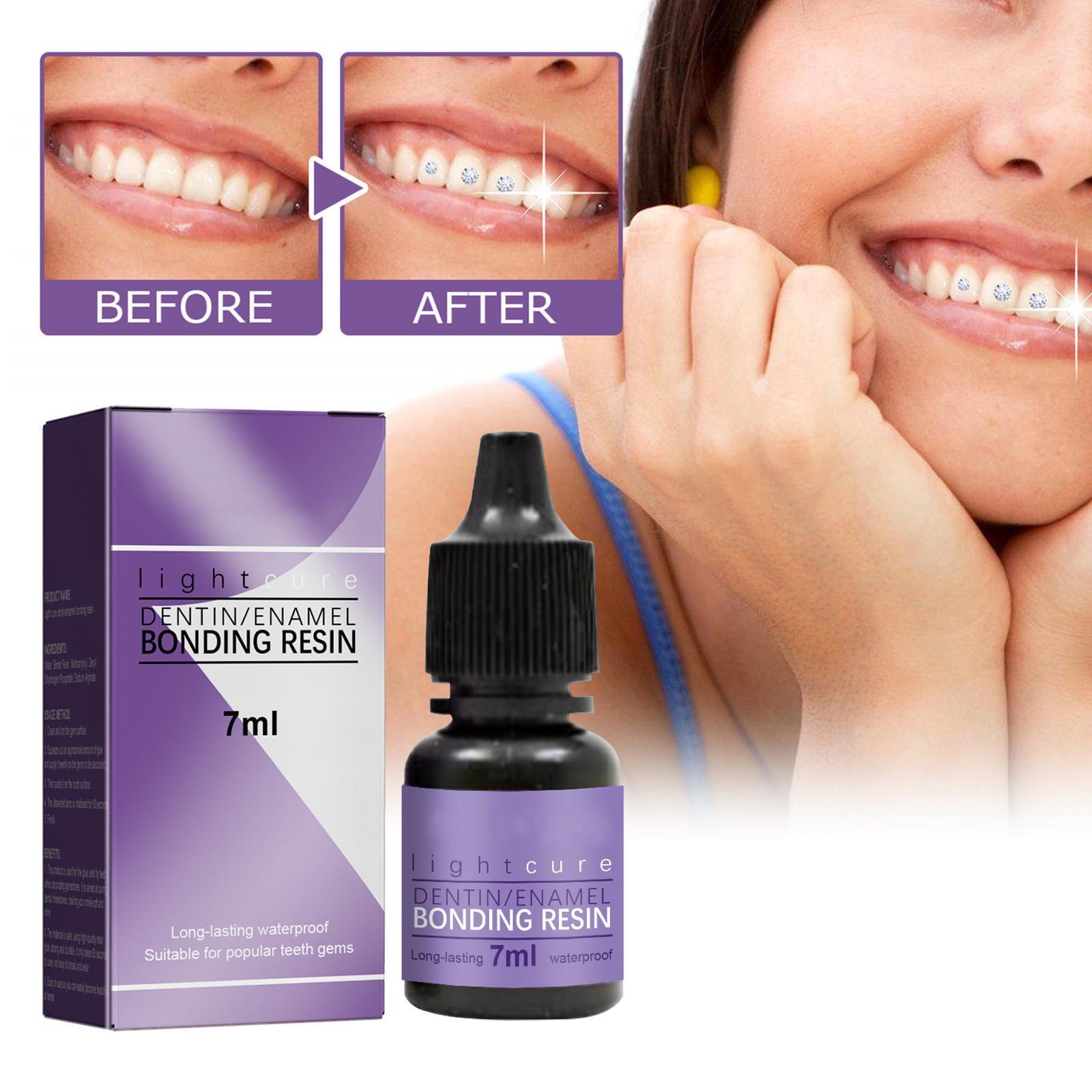 Teeth Decoration Glue Solidify Tooth Rhinestones Teeth Decor Teeth ...