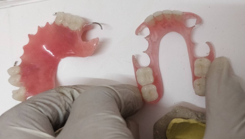 Flipper Upper & Lower Set of Affordable Custom Flexible Valplast ...