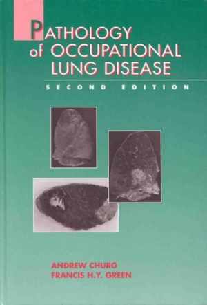 Pathology of Occupational Lung - Hardcover, by Churg Andrew; Green - Very Good | eBay