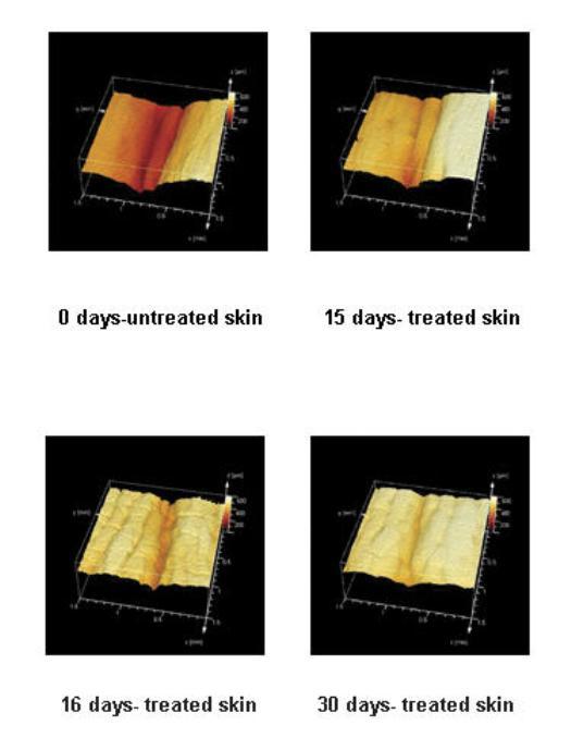 COLLAGEN BOOSTER PEPTIDE COMPLEX A blend of Hexapeptide-9, Acetyl ...