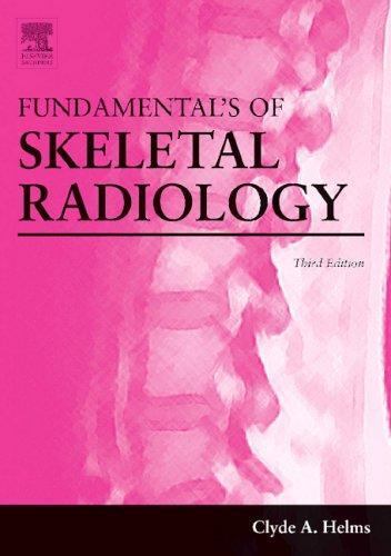 Fundamentals of Radiology Ser.: Fundamentals of Skeletal Radiology by ...