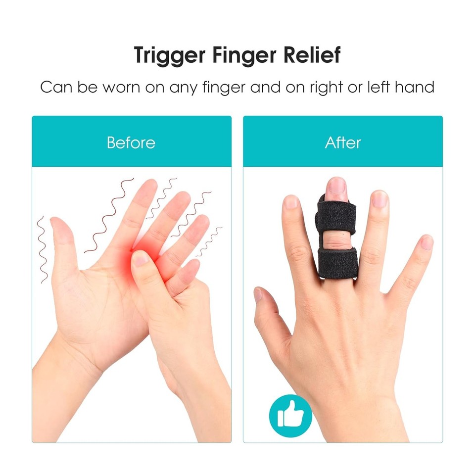 Finger Splint (2 Pack), Universal Finger Straightener, Broken and ...