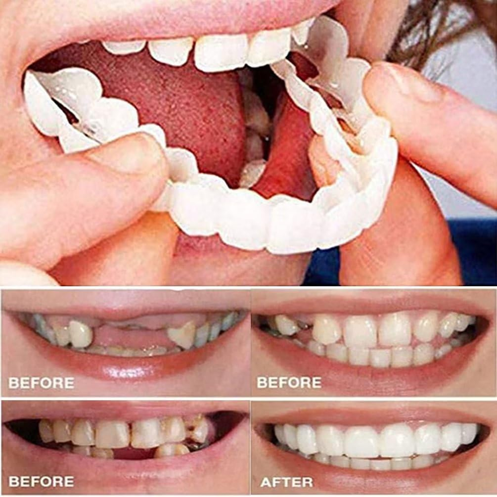 Womcare Temporary Tooth Repair Kits for Filling the Missing Broken ...