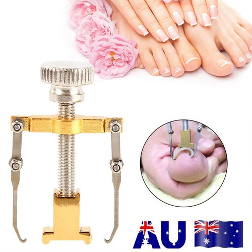 Ingrown Toenail Toe Fixer Recover Correction Device Pedicure Foot Nail ...