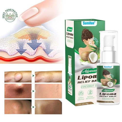 Coconut oil fat nourishing cream, subcutaneous fat cream lumps massage ...