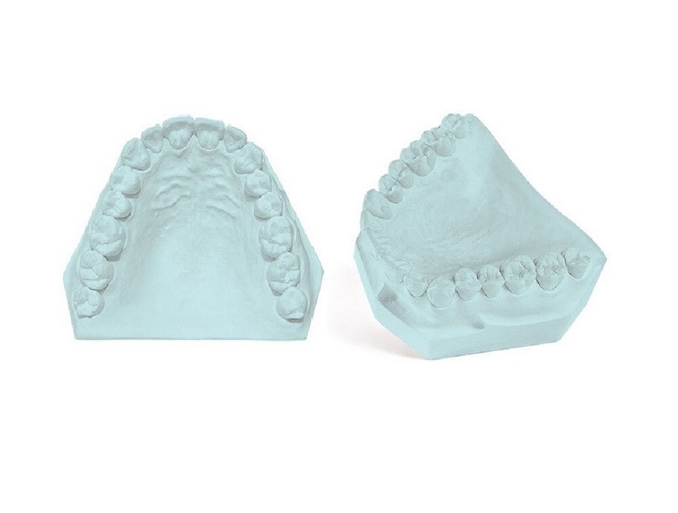 DENTAL GYPSUM DIE STONE TYPE IV BLUE HIGH STRENGTH COMPOUND LOW ...