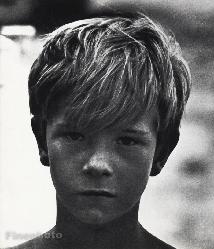 Lord Of The Flies Mulberry Birthmark Boy