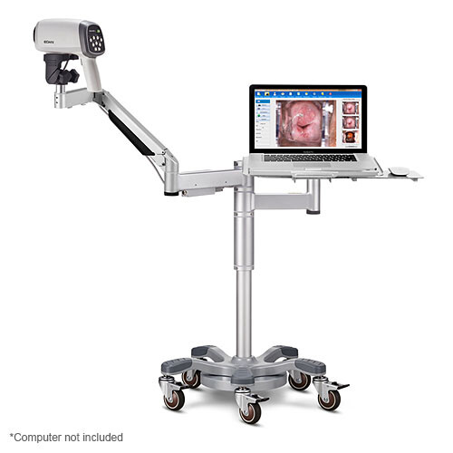 NEW ! EDAN C6AHD Colposcope w/HD Camera + 40 LED Illumination | eBay