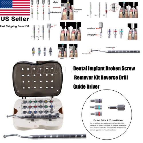 Dental Universal Implant Screw Removal Kit Torque Wrench Screw Drivers ...