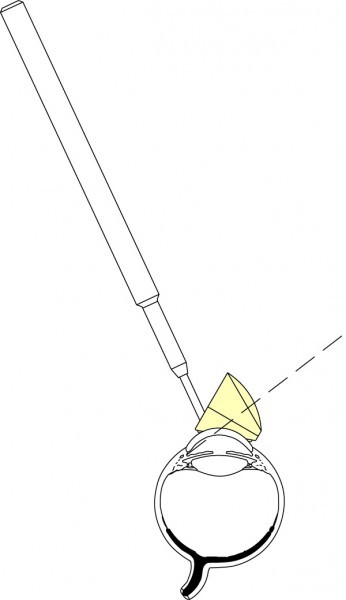 Ocular Swan Jacob A/C Gonio Prism 8mm OSJAG8 | eBay