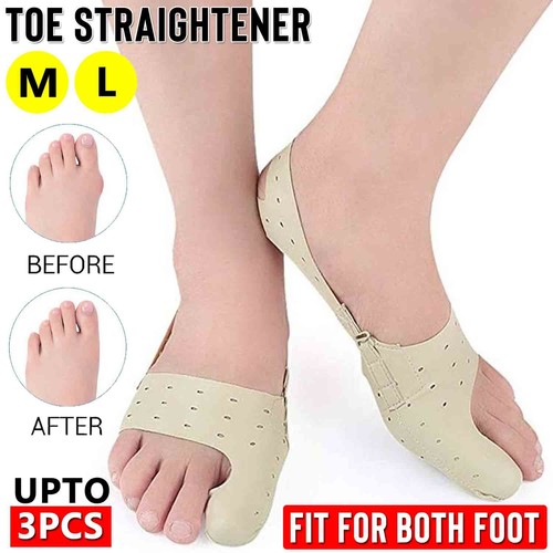 Bunion Corrector Big Toe Splint Hallux Valgus Straightener Foot ...