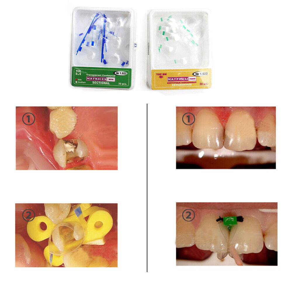 30Pc/Box Dental Transparent Plastic Matrix Sectional Contoured Matrices ...