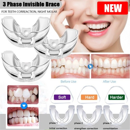 Invisible Dental Orthodontic Braces Teeth Corrector Alignment Trainer ...