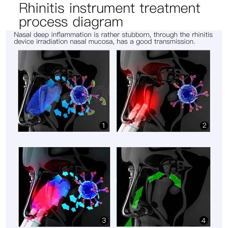 BioNase Nose Rhinitis Sinusitis Cure Therapy Massage Hay fever Low ...