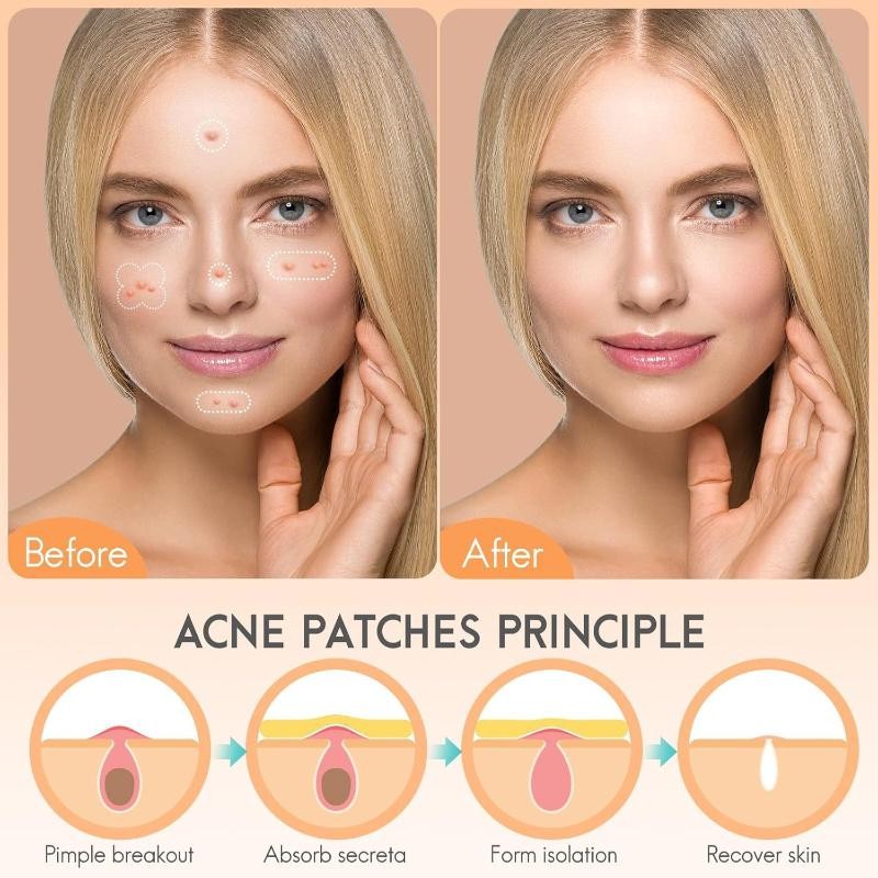 128Pcs Acne Pimple Plasters Patch Removal Blemish Control Skin Facial ...