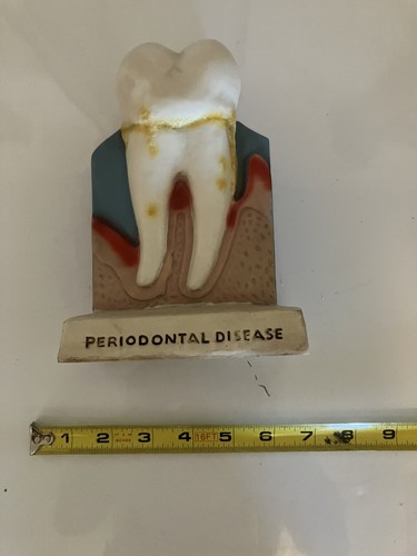 Vintage Giant tooth teeth brushing dental education Periodontal Display ...