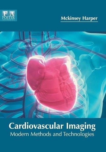 Cardiovascular Imaging: Modern Methods and Technologies (Copertina ...