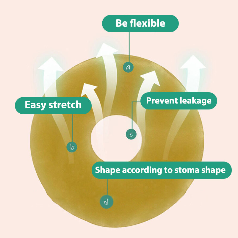 Ostomy Paste Ring Baseplates Care Products Leak-Proof Ring For Ostomy ...