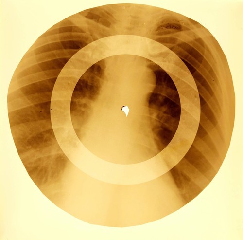 X-RAY USSR ROENTGEN BONES RECORD ORIGINAL OLD RIBS 15 | eBay