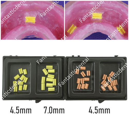 Dental Clips Retention Overdenture Rider Hader Bar Attachment Short 4 ...