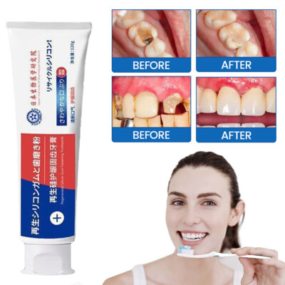 120g Upgrade Quick Repair of Cavities Caries Removal of Plaque Stains ...