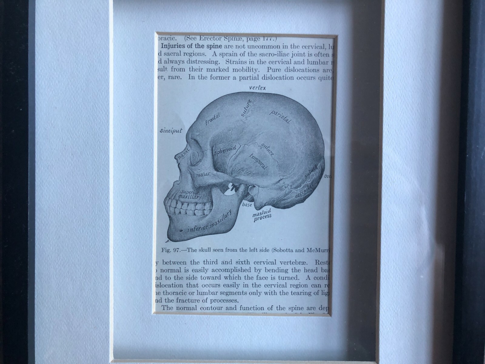 MEDICAL SCIENCE ODD: Framed Skull Medical Plate Anatomy and Physiology ...