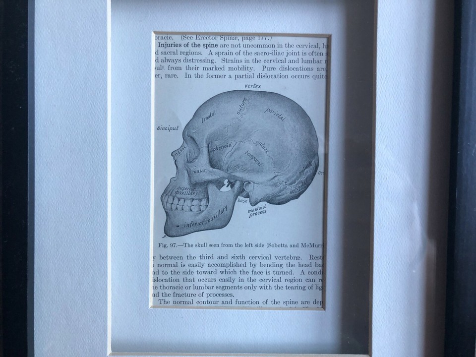 MEDICAL SCIENCE ODD: Framed Skull Medical Plate Anatomy and Physiology ...