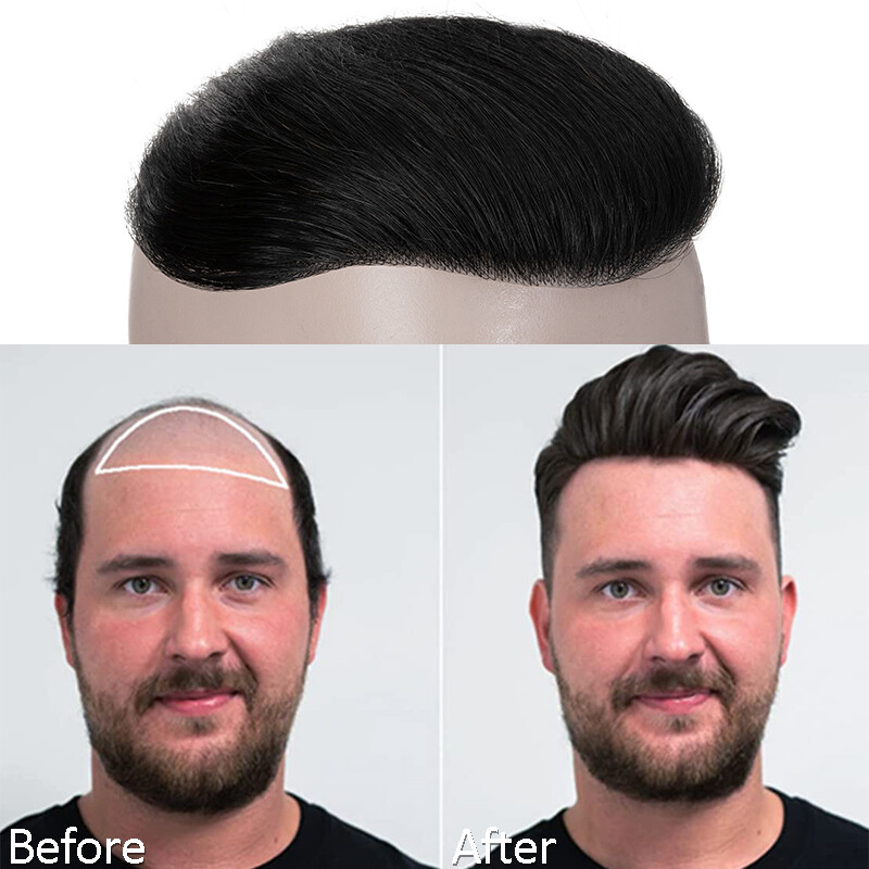 Mens Frontal Receding Hairline Toupee 100% Remy Human Hair Hairpiece ...