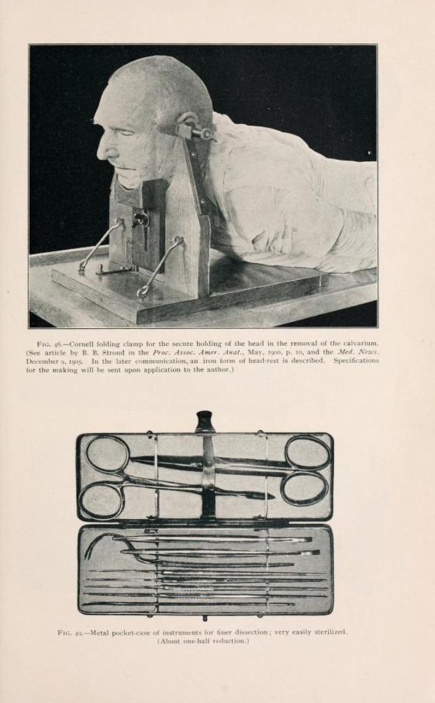 46 ANTIQUE HUMAN AUTOPSY BOOKS ON USB - POST MORTEM SCIENCE MEDICINE ...