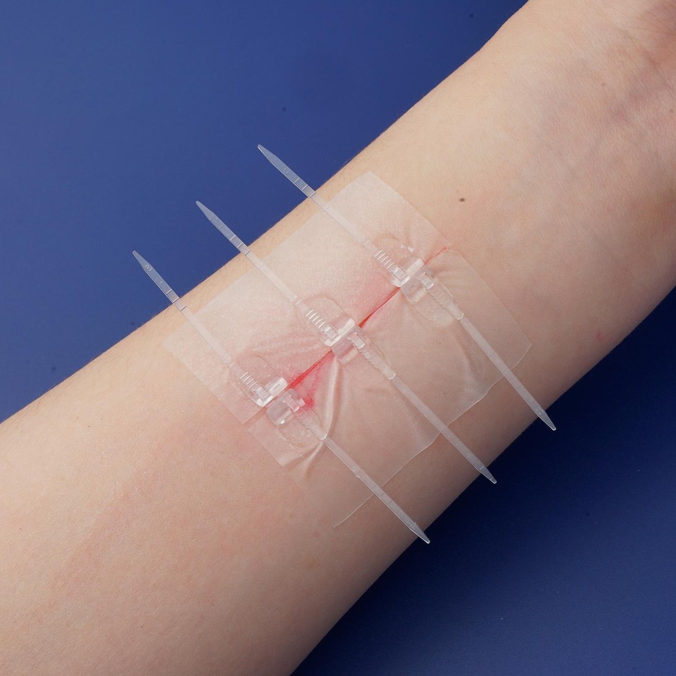 Bandage Band Aid Zip Stitches Zip Tie Wound Closure Adhesive Suture ...