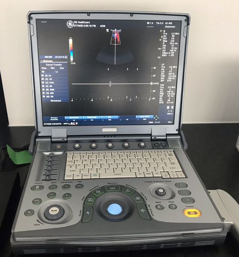 GE Logiq E portable ultrasound system | eBay