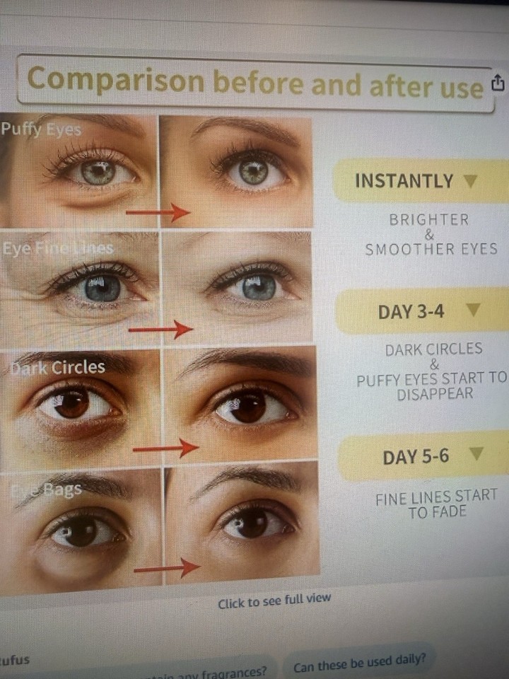 24K Gold under Eye Patches-60 Pack for Puffy Eyes, Dark Circles, Bags ...