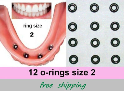 12 + 2* rubber O-Rings size 2 - for Mini Dental Implants - INTRA LOCK ...